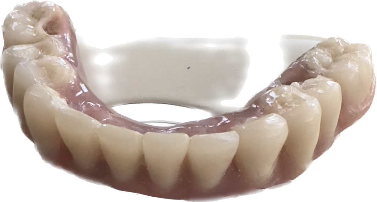 Screw-In Dentures: A New Smile Awaits You